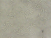 FungalSporesCrescentShapedConidia | Turfgrass Diagnostic Lab